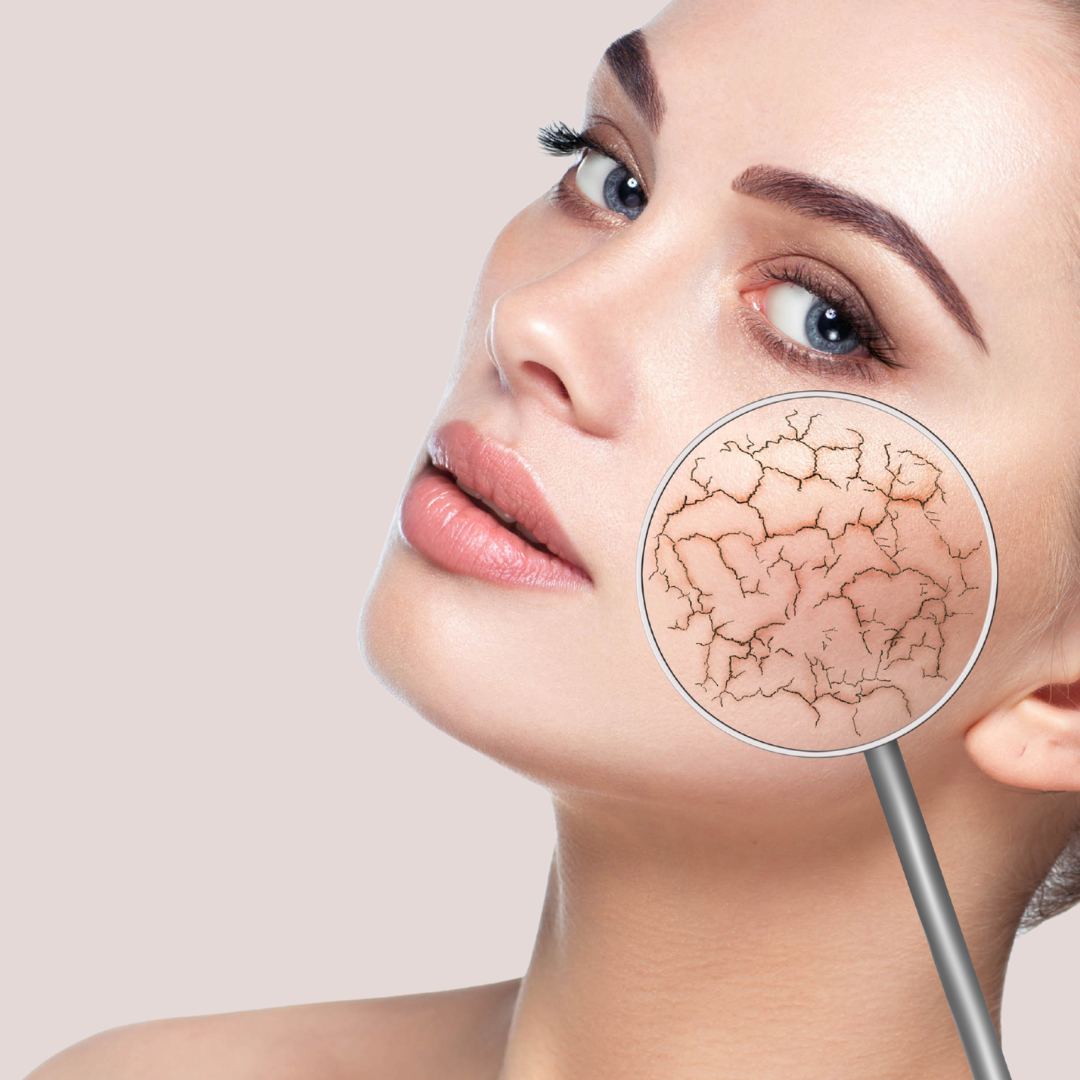 How To Get Rid Of Dry Flaking Skin In 7 Days | Zen Botanics